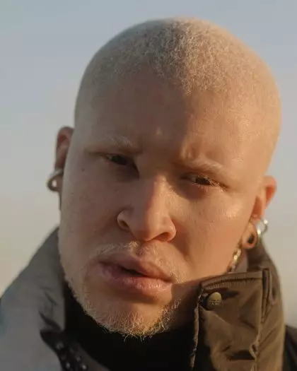 Hatsarana tsy fahita firy: 10 albino, avy amin'ireo izay sarotra horesahina 573_10