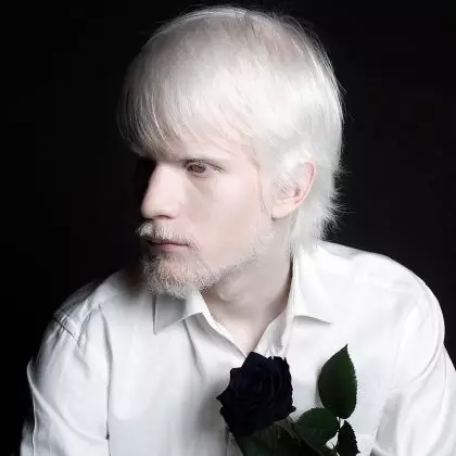 Seldsume skientme: 10 Albino's minsken, fan dyjingen dy't lestich binne om út te trillen 573_3